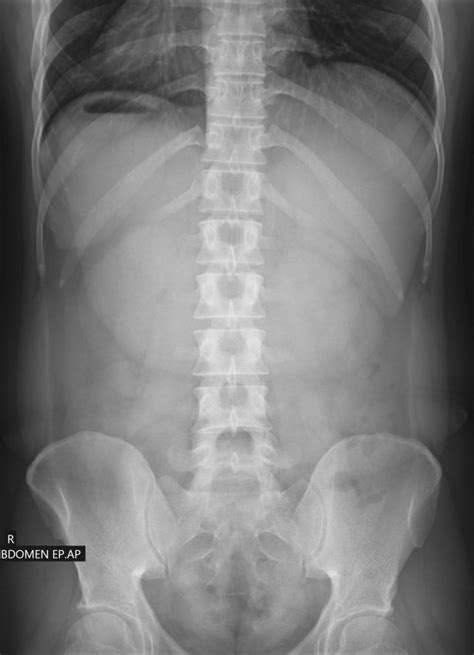 Dr Muhammad Shoyab On Linkedin Embryology Axr