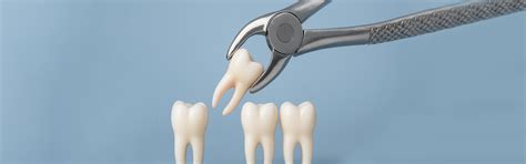 How Proper Aftercare Prevents Dry Socket After Tooth Extraction
