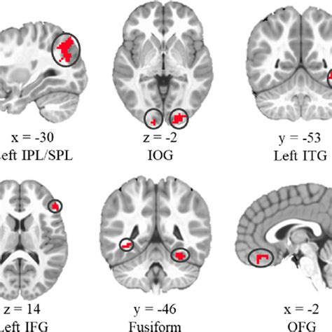 Rois Used In Hippocampal Functional Connectivity Analyses Adapted From Download Scientific