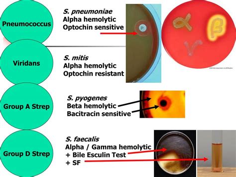 Streptococcus Mitis Antibiotic Treatment