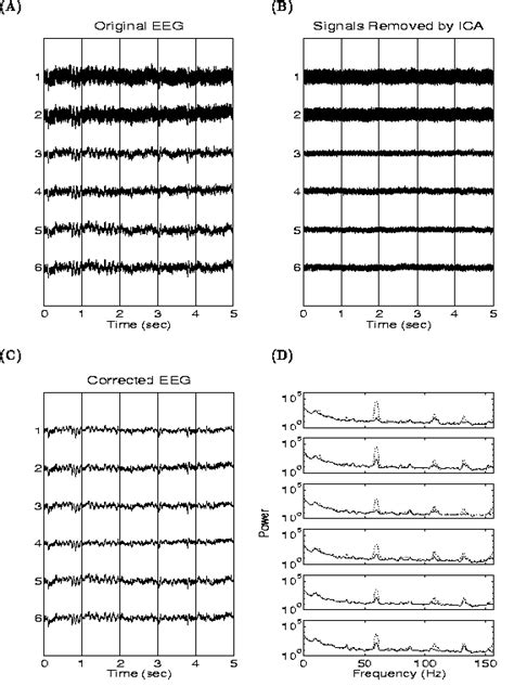 Eeg Artifact Removal With Blind Source Separation