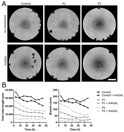 Ijms Free Full Text Endothelial Cell Dysfunction And Hypoxia As