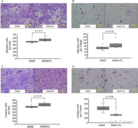 Transwell实验——原理、步骤、注意事项、示例图 知乎