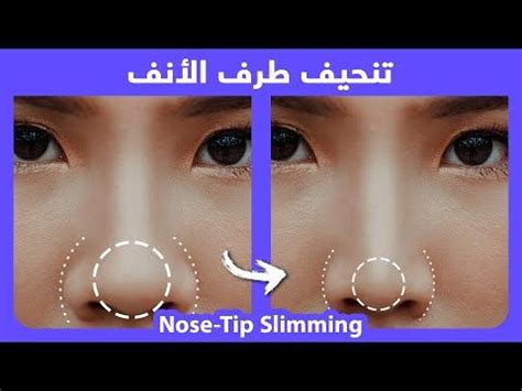 How To Naturally Slim The Nose Tip Fix Wide Nose Tip Fix Bulbous Nose Tip Bulbous Nose