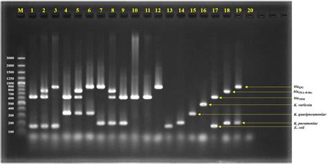 Multiplex Pcr Detection Of Common Carbapenemase Genes And Identification Of Clinically Relevant