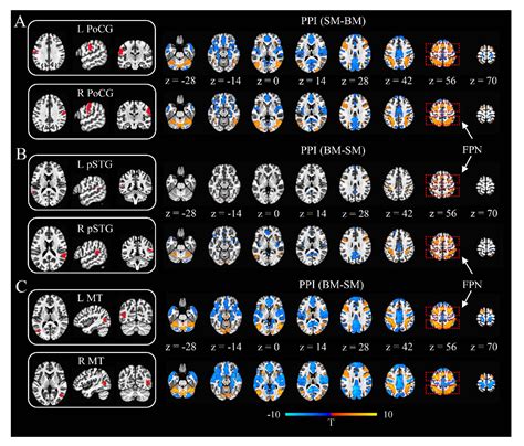 Figure 4 From A Domain General Frontoparietal Network Interacts With Domain Preferential