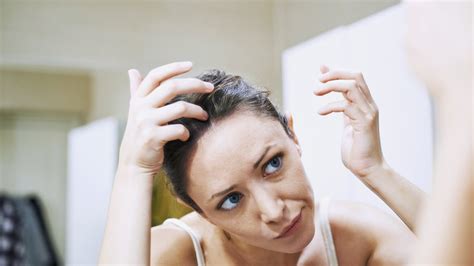 How To Get Rid Of Dandruff