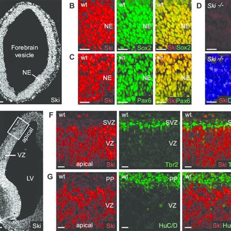 Fig S4 Proliferation Of Apical And Intermediate Progenitors Is