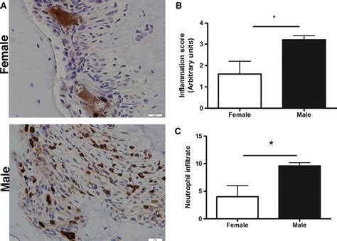 Figure 1 From Sex‐based Differential Regulation Of Bacterial‐induced Bone Resorption Semantic