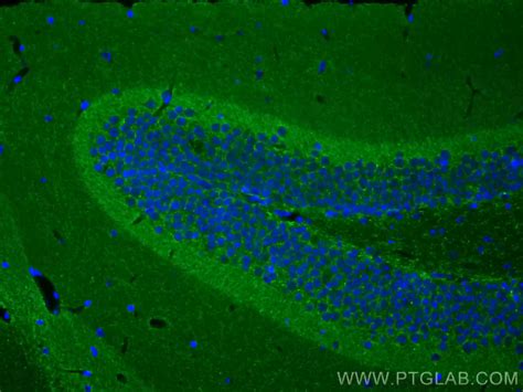 Synaptic Marker Product Focus Proteintech Group