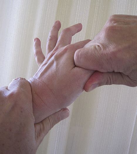 Scaphoid Fracture Anesthesia Key Scaphoid Fracture Anesthesia Key