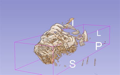 Add Reference Coordinate System On Patient · Issue 1006 · Plustoolkit