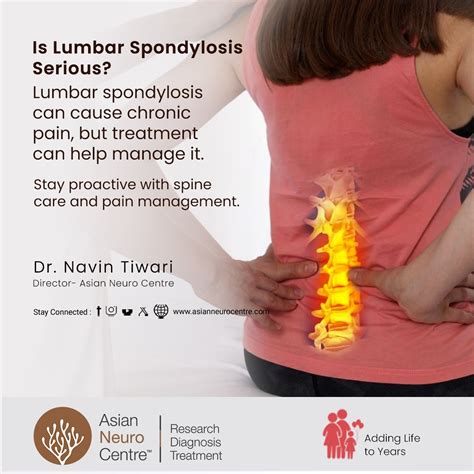 Is Lumbar Spondylosis Serious