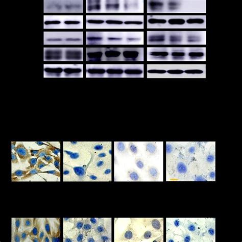 Identification Of Mutant Braf Expression By Reverse Download Scientific Diagram