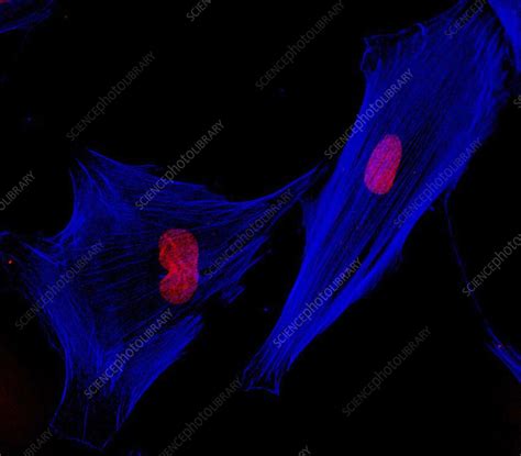 Human Fibroblast Cells Light Micrograph Stock Image C056 6634 Science Photo Library
