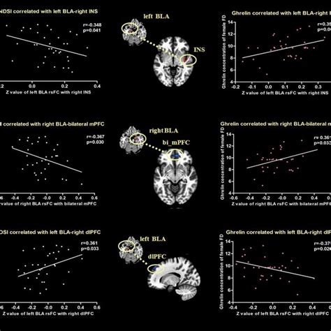 Sex Differences In The RsFC Between Amygdala Subregions And The Whole Download Scientific