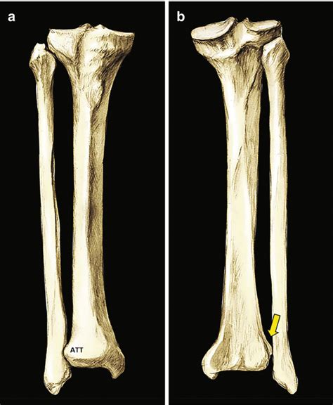 Tibia And Fibula Diagram Quizlet