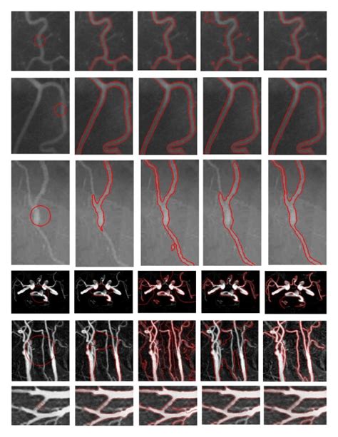 A Vessel Active Contour Model For Vascular Segmentation Tian 2014