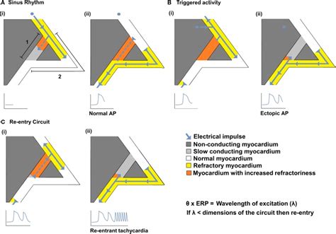 The Relationships Between θ And Re Entrant Arrhythmia A Diagram