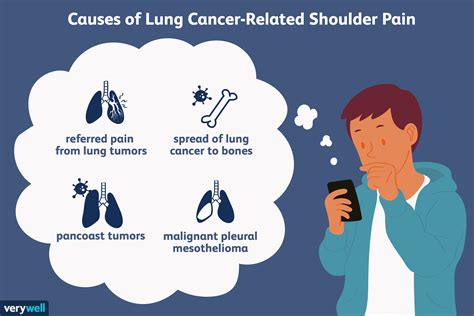 When Might Shoulder Pain Be A Sign Of Lung Cancer Or Mesothelioma