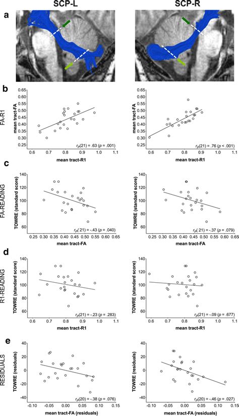 Associations Among Fractional Anisotropy FA From Diffusion MRI R Download Scientific