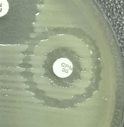 I Have Question About Diagnosis Of A Antibiogram Pattern Of A Bacteria Researchgate