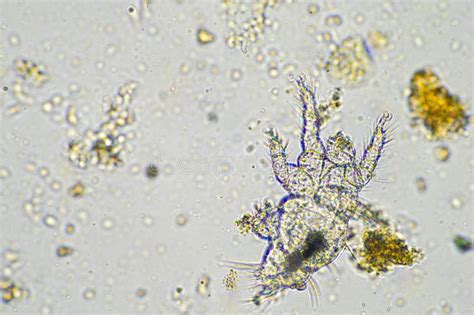 Fungi Under Light Microscope