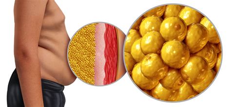 Hipoderme O Que É Funções E Cuidados Com A Camada Subcutânea Vuelo