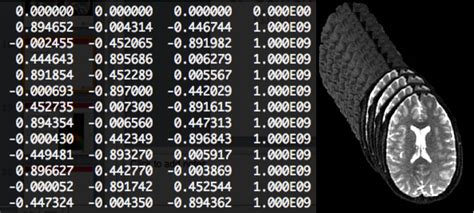 Dti Quality Control Part 2 Tensor Fitting Diffusion Imaging