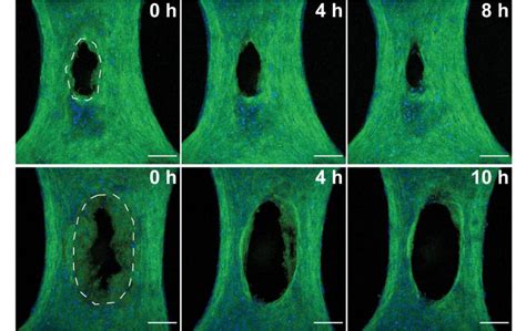 Discovery Of Skin Cell Function Could Open Doors To Improved Burn Healing