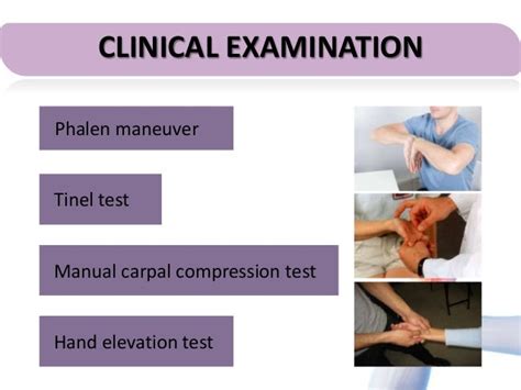 Carpal Tunnel Syndrome