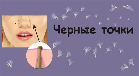 Как избавиться от черных точек