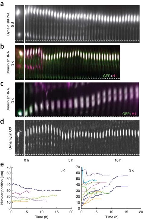 Effects Of Dynein Functional Inhibition On Interkinetic Nuclear