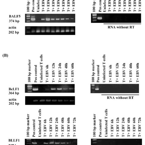 Kinetics Of Expression Of Ebv Transcripts In Ebv Infected T Cells