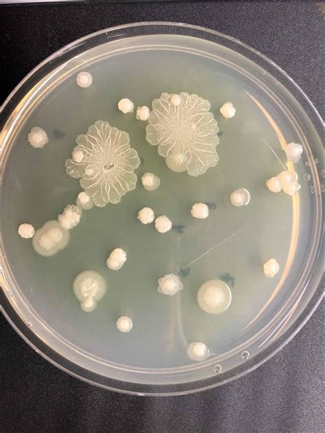 Pseudomonas Fluorescens Colony Morphology