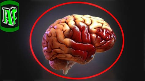 რა ასაკიდან იწყებს ტვინი დაბერებას Youtube