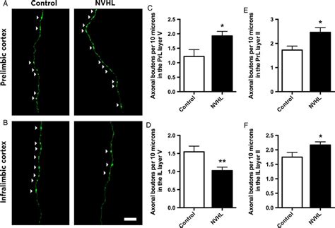 Analysis Of The Anterograde Tracing A Reconstruction Of Confocal
