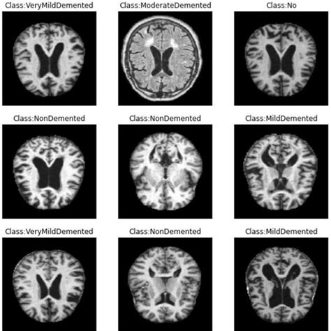 Various Brain Mri Scans Download Scientific Diagram