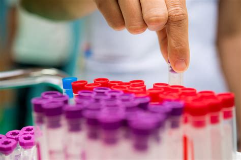 실험실 에서 테스트 튜브에서 혈액 샘플을 분석 하는 실험실 기술자 조수 의료 제약 및 과학 연구 및 개발 개념 Stem 주제에 대한 스톡 사진 및 기타 이미지 Istock