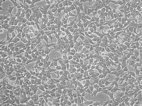 293t细胞（hek 293t人胚肾细胞）思泰默细胞