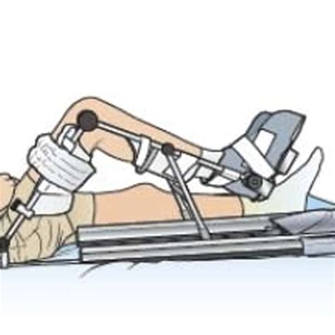 Knee Exercise Cpm Machine Physical Therapy Rental Healthcare Home Medical Supply Usa