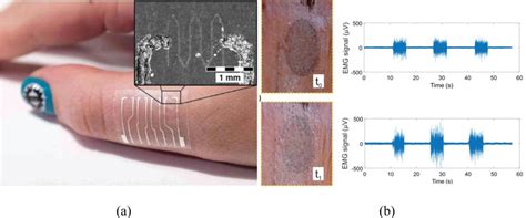 A Inkjet‐printed Graphenepedotpss Temperature Sensor On Skin