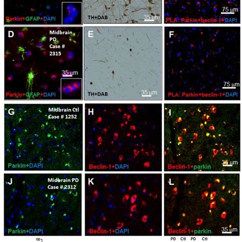 Immunostaining Of 20 µm Thick Mouse Brain Sections Showing Human Download Scientific Diagram