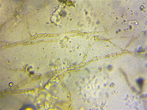 Плесень, это друг или нет? - информационная статья от интернет-магазина ...
