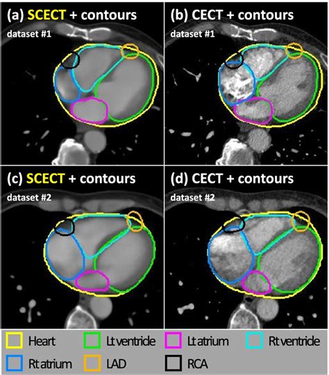 Representative Results Of Manual Contouring On Synthetic Download Scientific Diagram