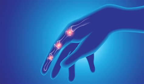 Rheumatoid Arthritis What Is Causes Diagnosis And Treatment