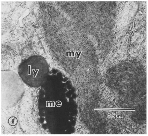 Electron Micrograph Of A Lysosome Found Within The Rpe My Myeloid Download Scientific