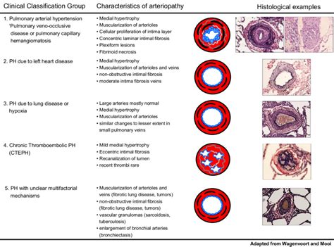 Correlate Of The Dana Point 2008 Clinical Classification With The