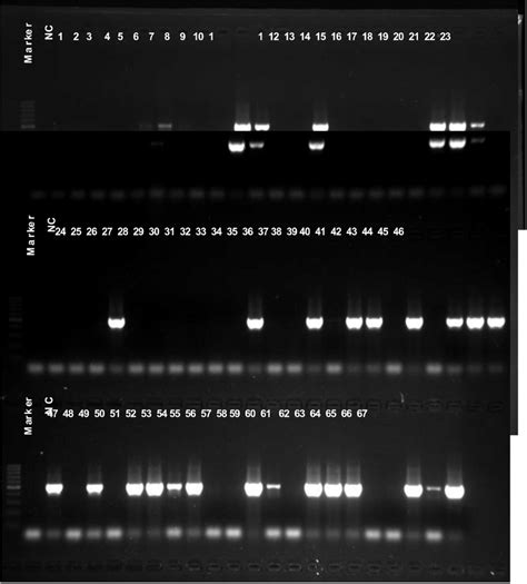 Meca Gene Detection All 67 Isolates Were Submitted For Meca Gene