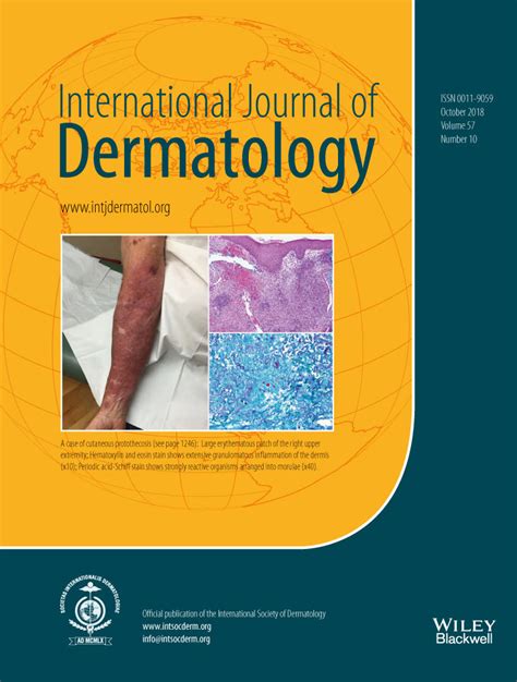 Recurrent Pyoderma Gangrenosum Developed After A Cesarean Section With